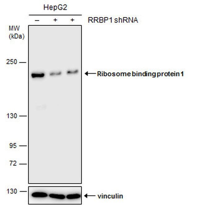 RRBP1 Monoclonal Antibody (P5610), Invitrogen™ 100 μL; Unconjugated ...
