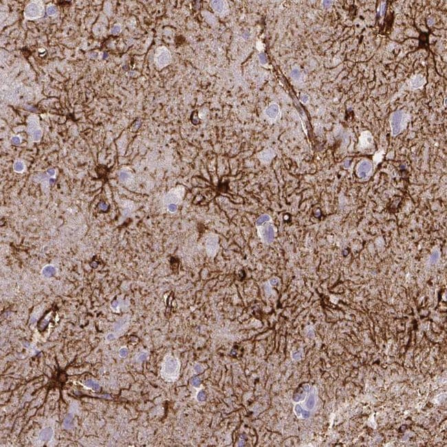 Invitrogen SLC22A2 Monoclonal Antibody (CL0628) 100 μL | Buy Online ...