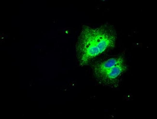 Invitrogen SLC7A8 Monoclonal Antibody (OTI5A9) 100 μL; Unconjugated ...