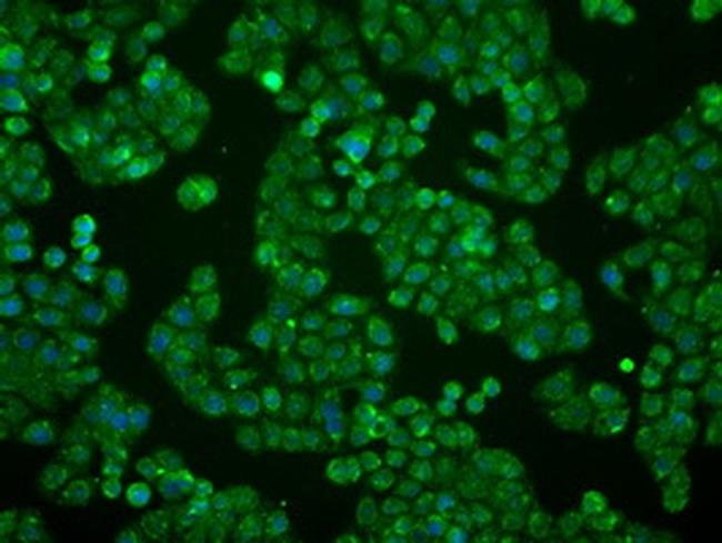Invitrogen BTN3A2 Monoclonal Antibody (OTI1A6) 100 μL | Buy Online ...
