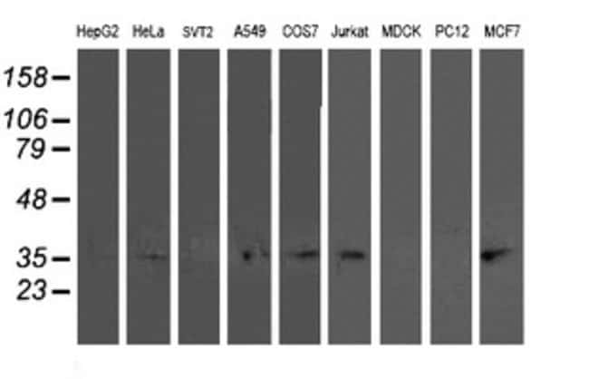 Invitrogen TOMM34 Monoclonal Antibody (OTI2A6) 100 μL; Unconjugated ...