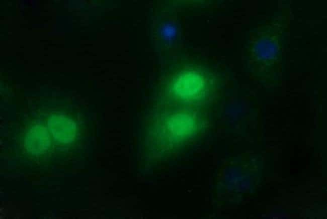 SIVA1 Monoclonal Antibody (OTI2B7), Invitrogen 100 μL; Unconjugated ...