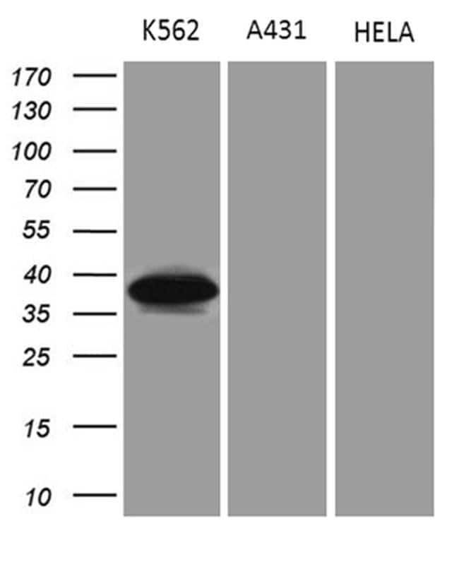 NMI Monoclonal Antibody (OTI2C1), Invitrogen 100 μL; Unconjugated ...