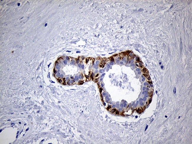 LAD1 Monoclonal Antibody (OTI7H8), Invitrogen 100 μL; Unconjugated ...