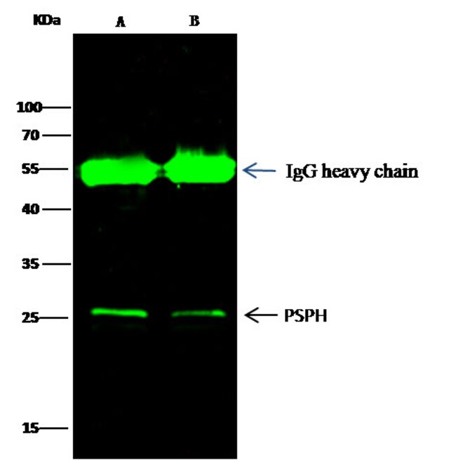 Invitrogen PSPH Recombinant Rabbit Monoclonal Antibody (001) 100 μL ...
