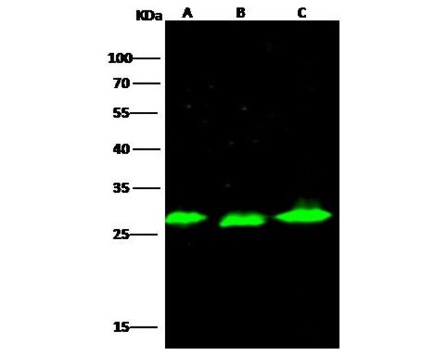 Invitrogen PSPH Recombinant Rabbit Monoclonal Antibody (001) 100 μL ...