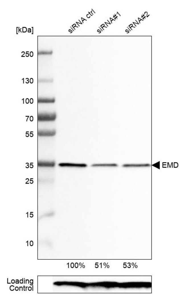 Invitrogen Emerin Monoclonal Antibody (CL0203) 100 μL | Buy Online ...