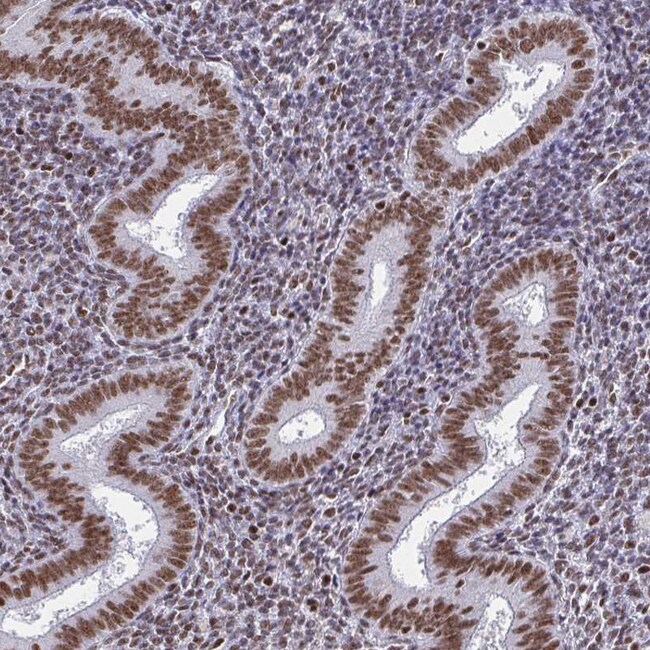 Invitrogen CTCF Monoclonal Antibody (CL0304) 100 μL; Unconjugated ...