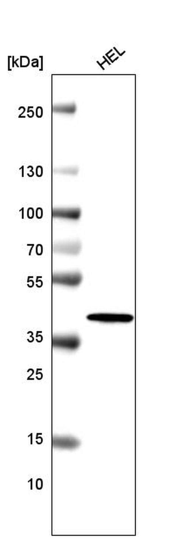 Histone Macro-H2A.1 Monoclonal Antibody (CL5245), Invitrogen™ 100 μL ...
