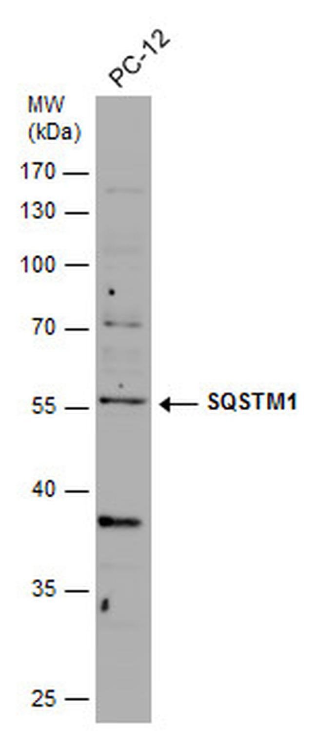 SQSTM1 Monoclonal Antibody (GT239), Invitrogen 100 μL; Unconjugated ...