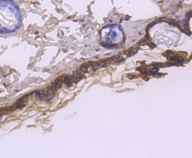 Cytokeratin 1 Recombinant Rabbit Monoclonal Antibody (SN72-08 ...