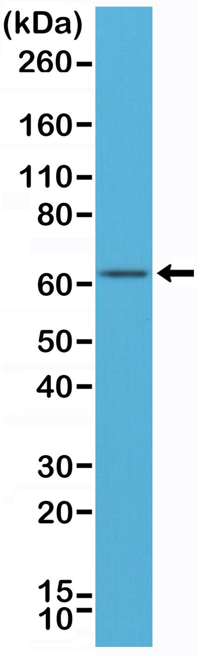 Estrogen Receptor alpha Recombinant Rabbit Monoclonal Antibody (RM292 ...