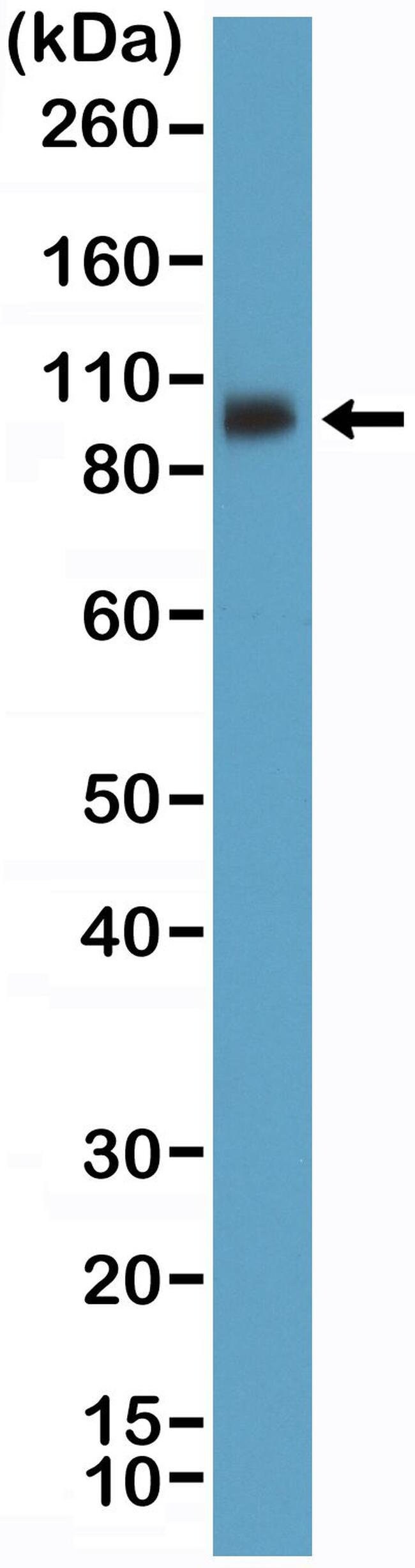 CD61 (Integrin beta 3) Recombinant Rabbit Monoclonal Antibody (RM382 ...