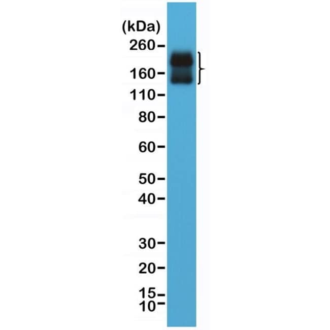 Invitrogen CD56 (NCAM) Recombinant Rabbit Monoclonal Antibody (RM315 ...