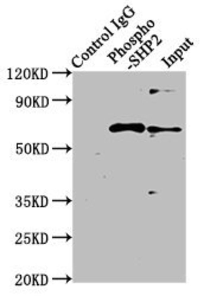 Phospho-SHP2 (Tyr542) Recombinant Rabbit Monoclonal Antibody, Invitrogen | Fisher Scientific