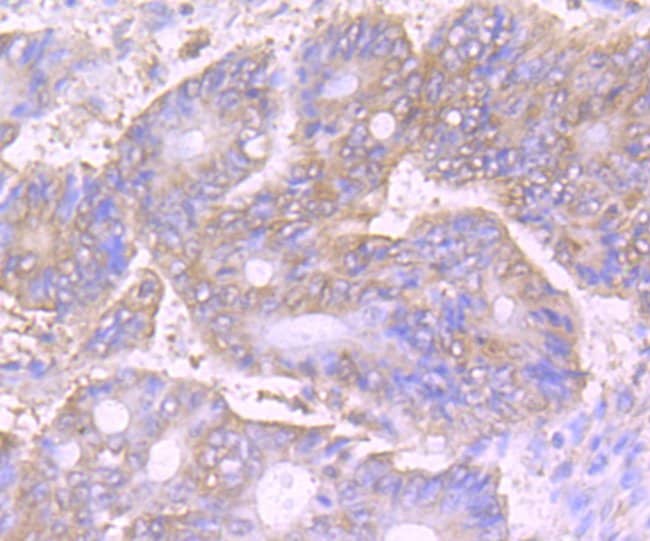 VPS35 Recombinant Rabbit Monoclonal Antibody (JB33-82), Invitrogen 100 ...