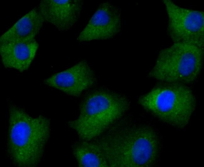 GABRA5 Recombinant Rabbit Monoclonal Antibody (JB34-19), Invitrogen 100 ...