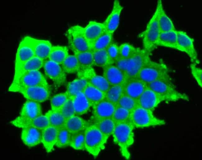 GABRA5 Recombinant Rabbit Monoclonal Antibody (JB34-19), Invitrogen 100 ...
