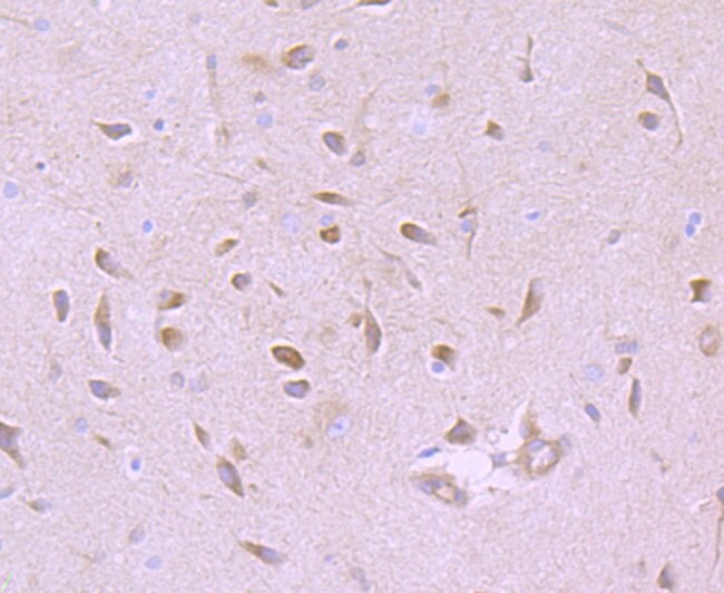 GABRA5 Recombinant Rabbit Monoclonal Antibody (JB34-19), Invitrogen 100 ...