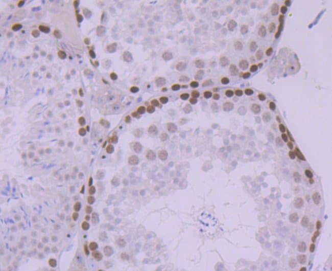 MCM5 Recombinant Rabbit Monoclonal Antibody (JB31-34), Invitrogen 100 ...