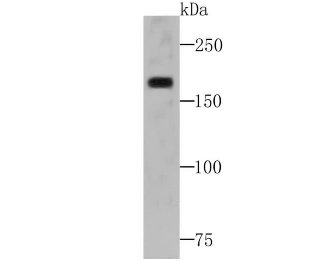 BAZ1B Recombinant Rabbit Monoclonal Antibody (JG36-32), Invitrogen 100 ...