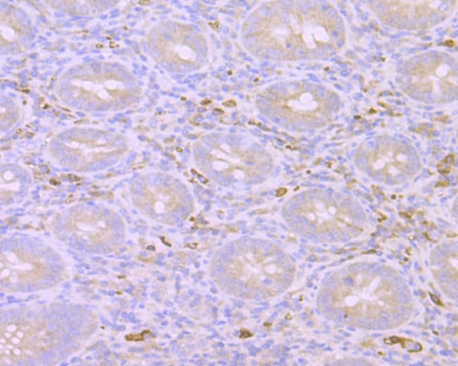 MIB1 Recombinant Rabbit Monoclonal Antibody (JG69-34), Invitrogen 100 ...