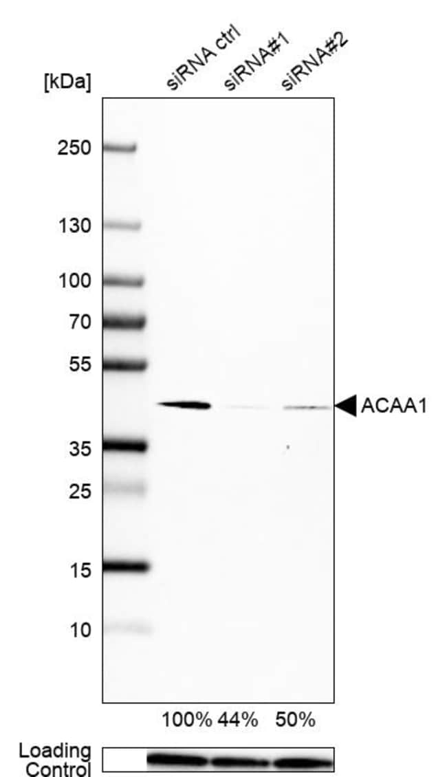 Invitrogen ACAA1 Monoclonal Antibody (CL2663) 100 μL; Unconjugated ...