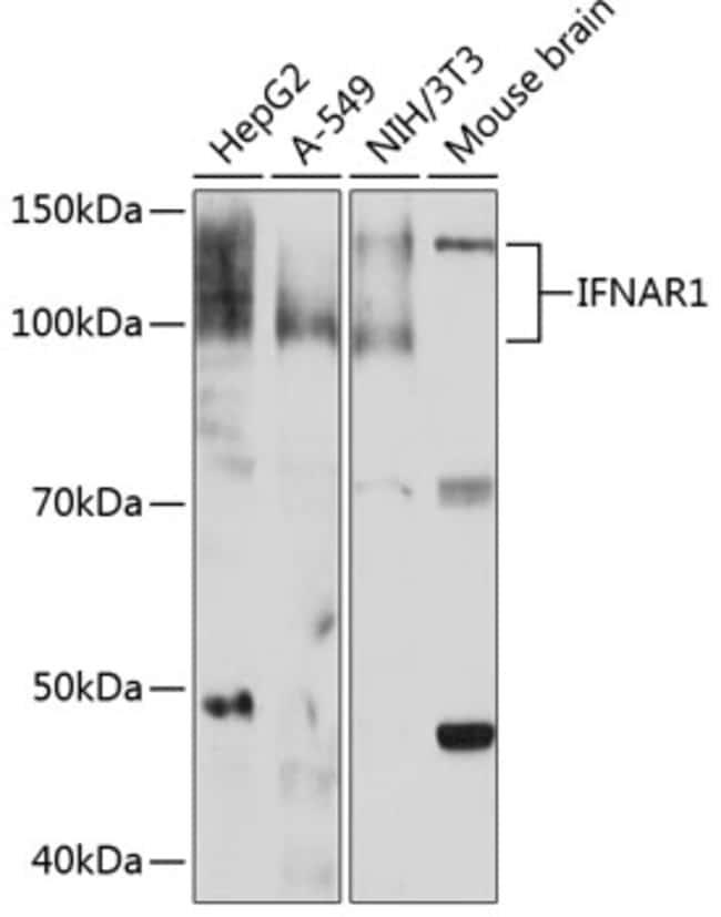 Invitrogen IFNAR1 Recombinant Rabbit Monoclonal Antibody (6N3L3) 100 μL ...