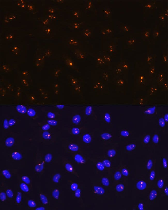 Fibrillarin Recombinant Rabbit Monoclonal Antibody (ARC0506 ...