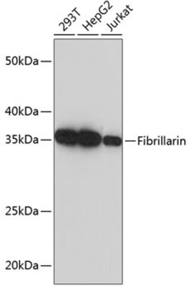 Fibrillarin Recombinant Rabbit Monoclonal Antibody (ARC0506 ...