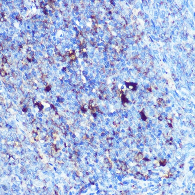 HLA-DRA Rabbit anti-Human, Rat, Unconjugated, Clone: ARC0518 ...