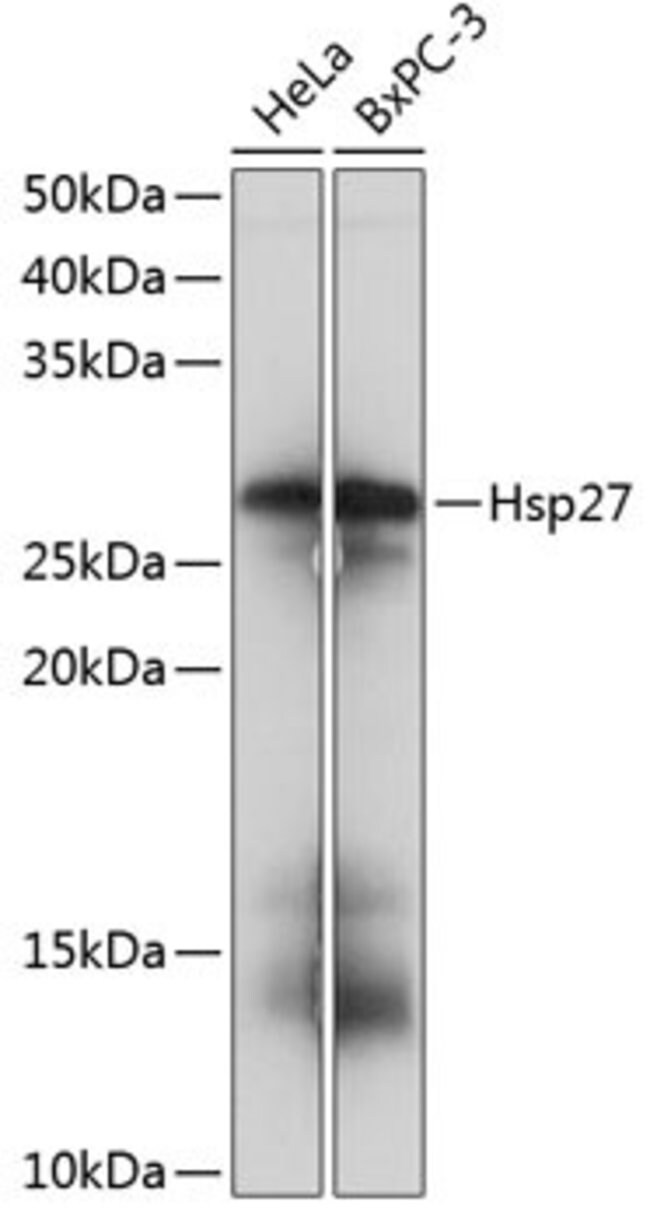 HSP27 Recombinant Rabbit Monoclonal Antibody (ARC0531), Invitrogen 100 ...
