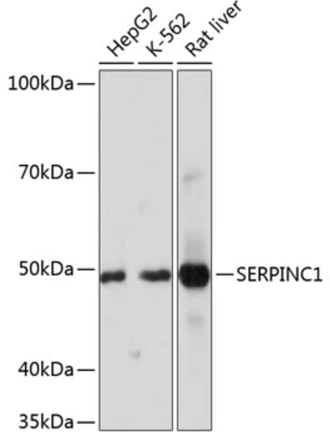 Invitrogen SERPINC1 Recombinant Rabbit Monoclonal Antibody (2X2V4) 100 ...