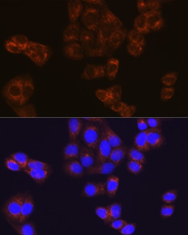 BMP4 Recombinant Rabbit Monoclonal Antibody (ARC0587), Invitrogen 100 ...