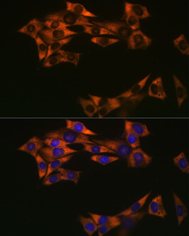 eIF4A1 Recombinant Rabbit Monoclonal Antibody (ARC0636), Invitrogen 100 ...
