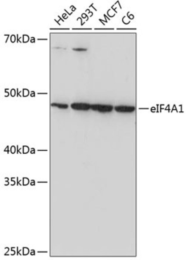 eIF4A1 Recombinant Rabbit Monoclonal Antibody (ARC0636), Invitrogen 100 ...