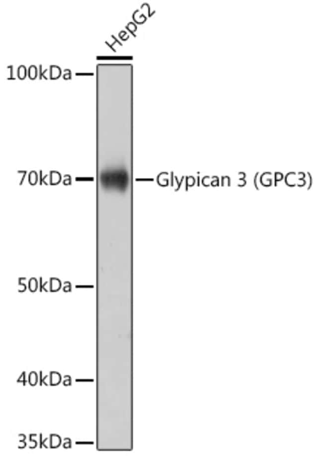 Glypican 3 Recombinant Rabbit Monoclonal Antibody (ARC0675), Invitrogen | Fisher Scientific