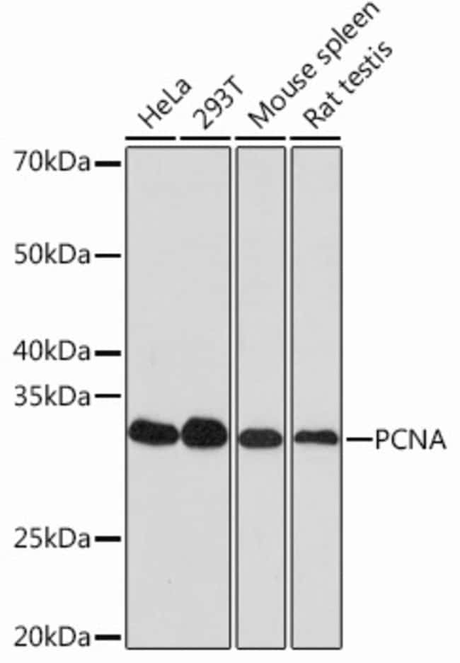 PCNA Recombinant Rabbit Monoclonal Antibody (ARC0710), Invitrogen 100 ...