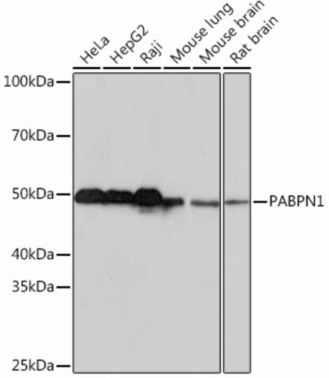 PABPN1 Rabbit anti-Human, Mouse, Rat, Unconjugated, Clone: ARC0730 ...