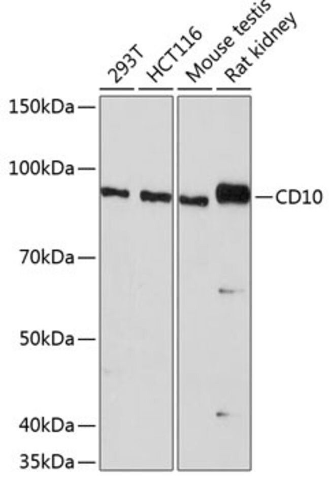 CD10 Rabbit anti-Human, Mouse, Rat, Unconjugated, Clone: ARC0443 ...
