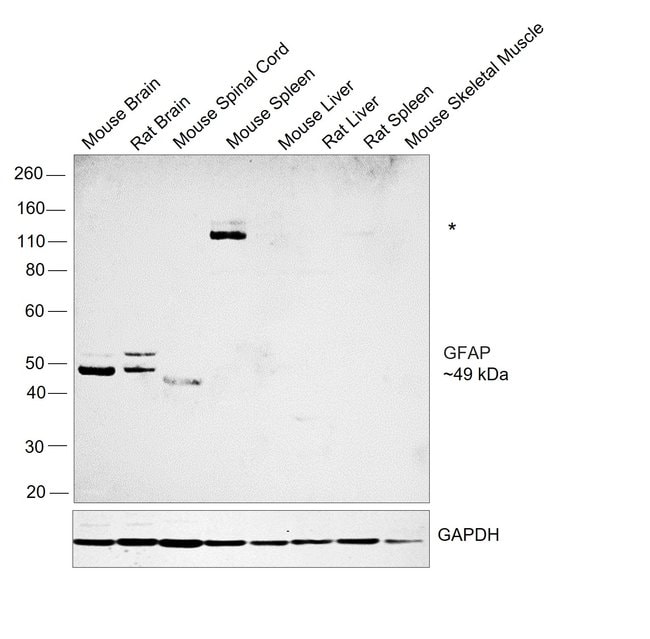 GFAP Recombinant Rabbit Monoclonal Antibody (ARC0206), Invitrogen 100 ...