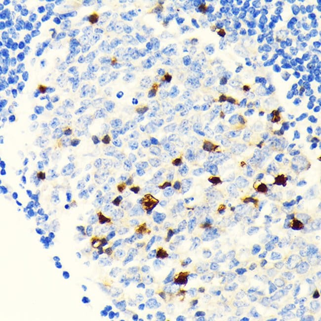 Parvalbumin Rabbit anti-Human, Mouse, Rat, Unconjugated, Clone: ARC0385 ...