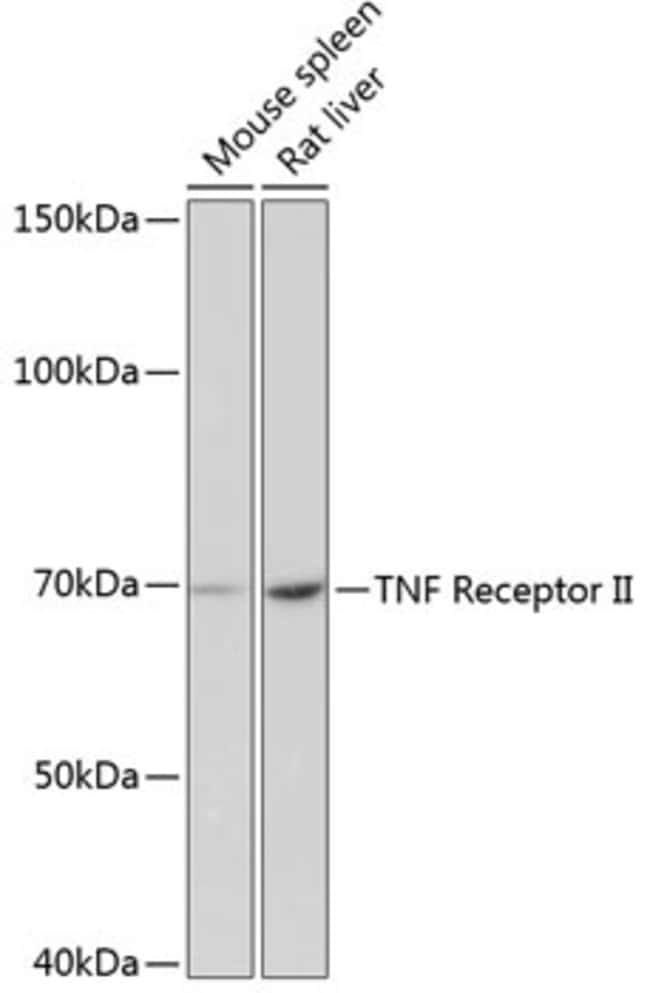 TNFR2 Rabbit anti-Human, Mouse, Rat, Unconjugated, Clone: ARC0397 ...