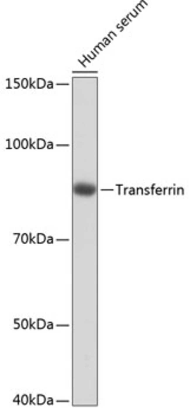 Invitrogen Transferrin Recombinant Rabbit Monoclonal Antibody (1S7G8 ...