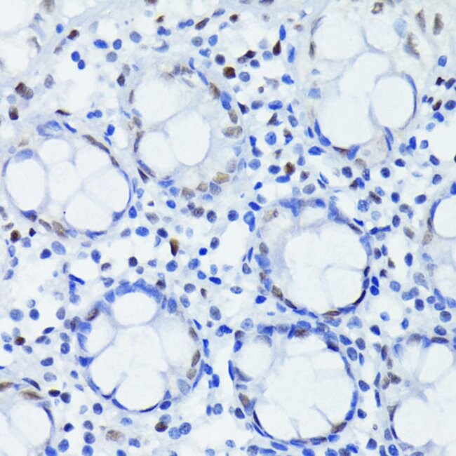 HIF-1 beta Rabbit anti-Human, Unconjugated, Clone: ARC0010, Invitrogen ...