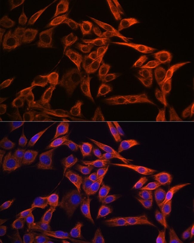 Vimentin Recombinant Rabbit Monoclonal Antibody (ARC0086), Invitrogen ...