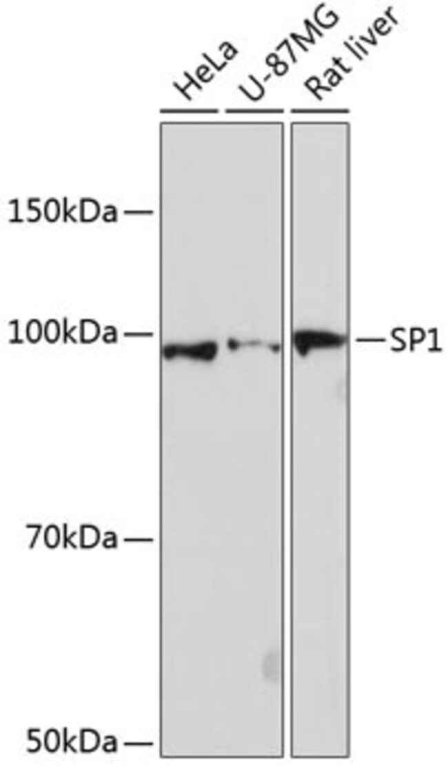 SP1 Recombinant Rabbit Monoclonal Antibody (ARC0128), Invitrogen™ 100 ...