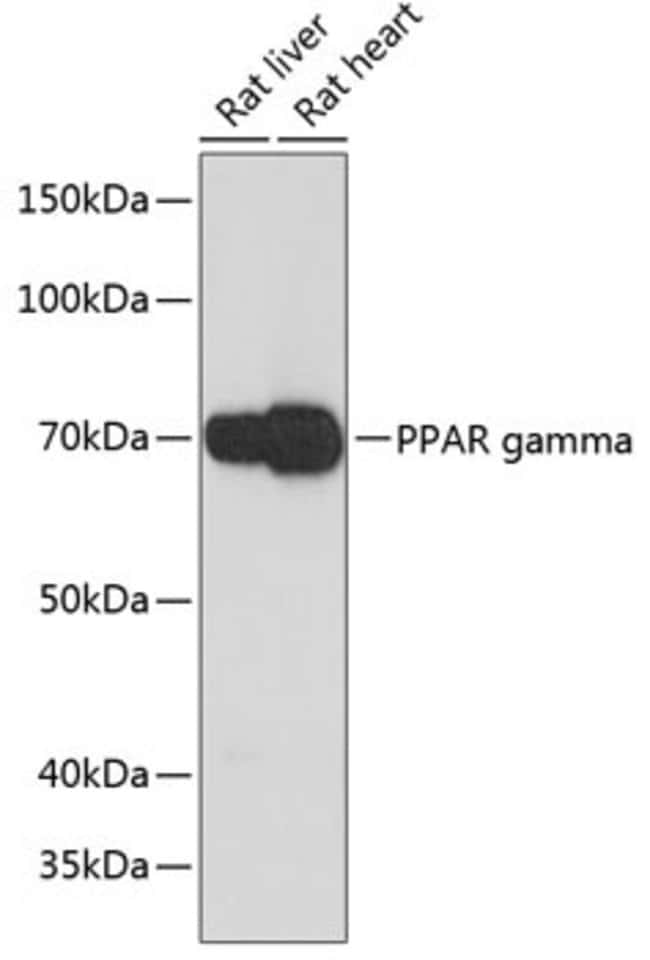 PPAR gamma Recombinant Rabbit Monoclonal Antibody (ARC0155), Invitrogen™ 100 μL; Unconjugated ...