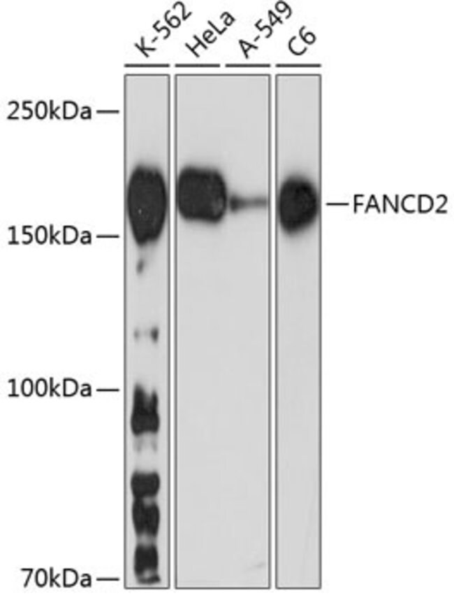 FANCD2 Recombinant Rabbit Monoclonal Antibody (ARC0172), Invitrogen 100 ...