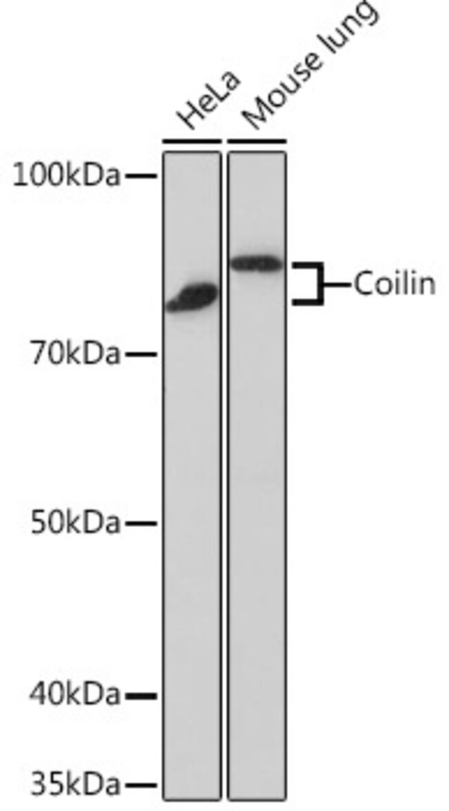 Coilin Recombinant Rabbit Monoclonal Antibody (ARC0785), Invitrogen 100 ...